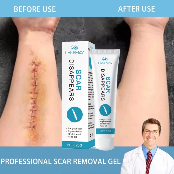 Scar removal cream Scar repair cream Remove scabies scars Remove old ...