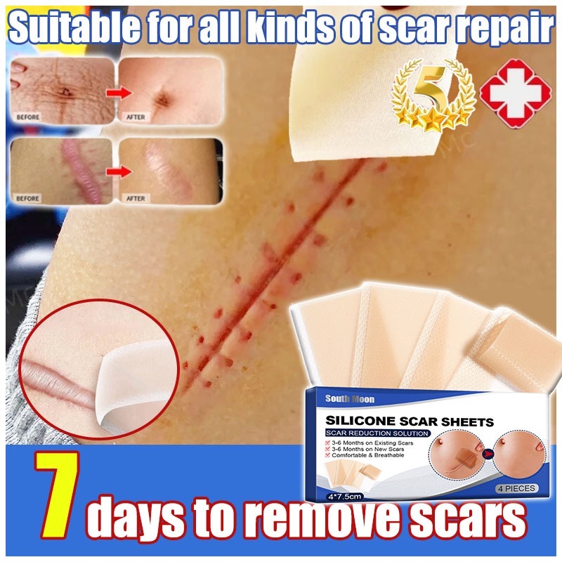 Medical Silicone Scar Sheet 4*7.5cm scar removal patch scar sheet /scar tape Self-adhesive ...