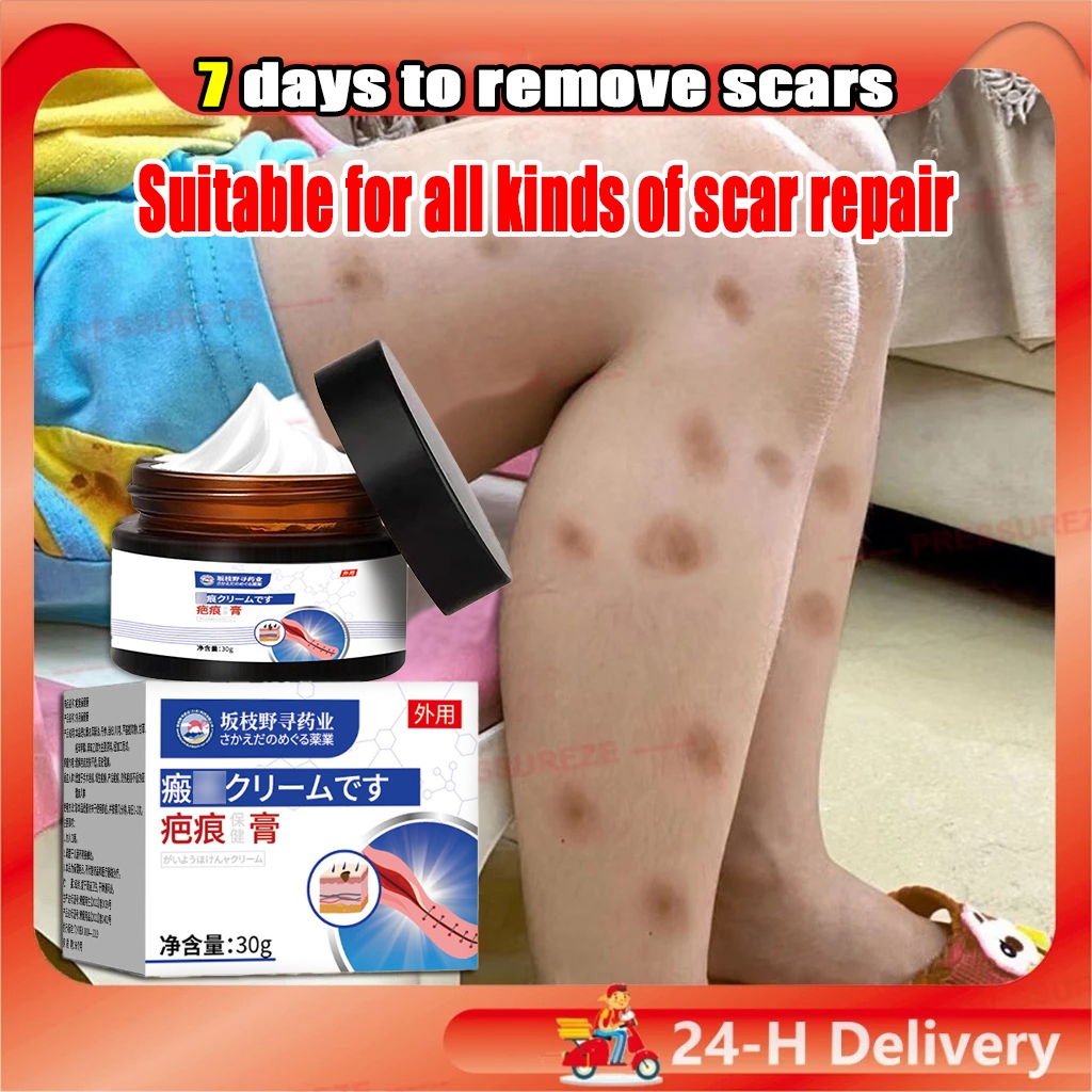 Scar Removal Cream Keloid Scar Removal dermatix ultra Scar Gel Acne ...
