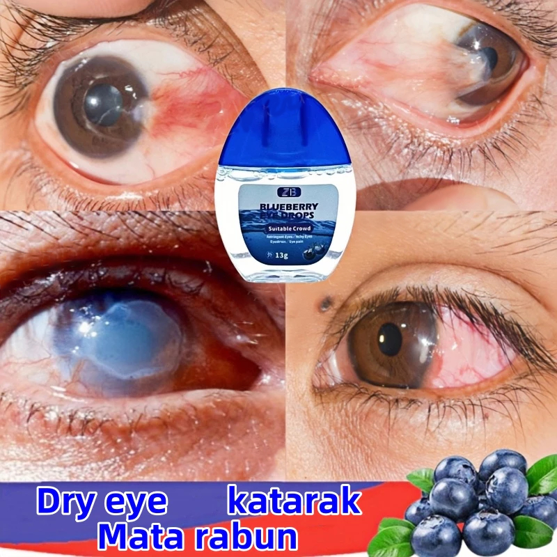Cataract eye drops, blueberry eye drops, dry eye drops for the ...