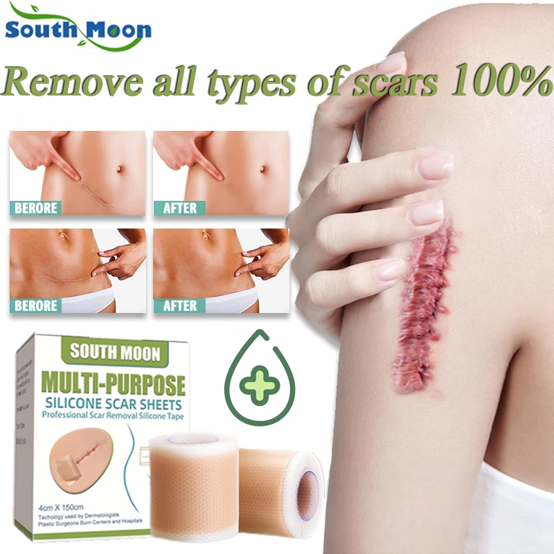 [South Moon] Scar Removal Patches , 4cmx150cm, Scar Sheet,Silicone Scar ...