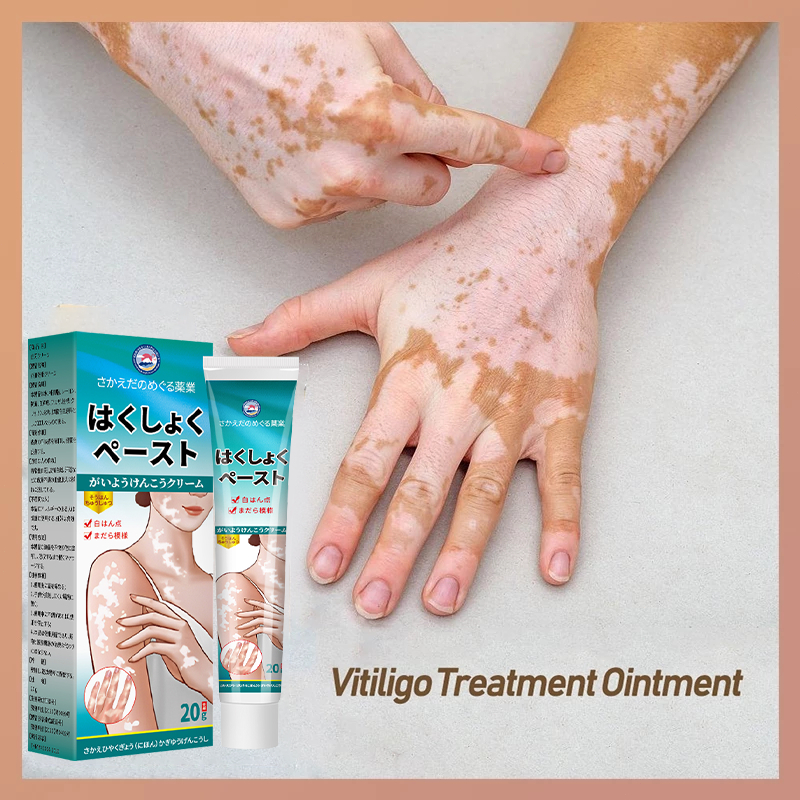 Vitiligo cream Vitiligo treatment cream Ubat vitiligo Menjalankan ...