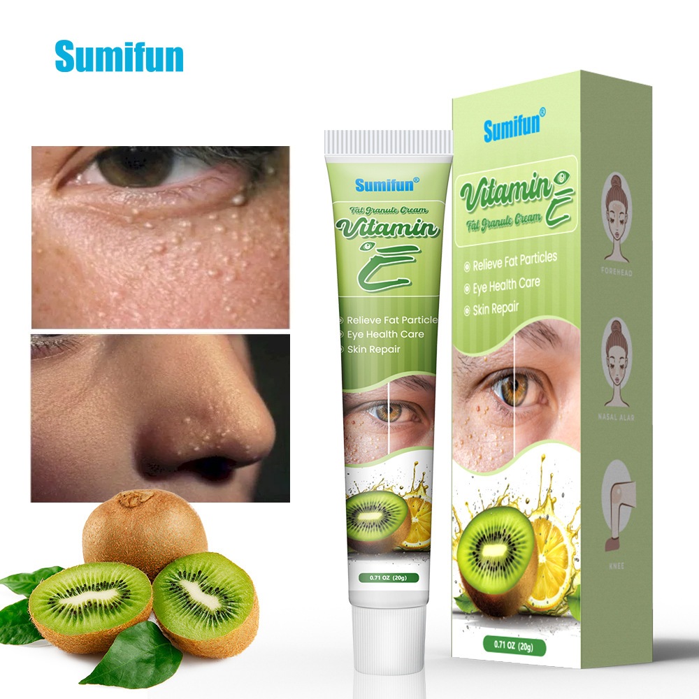 Eye Milia Removal Cream Original Vitamin E Fat Granules Remover Eye ...