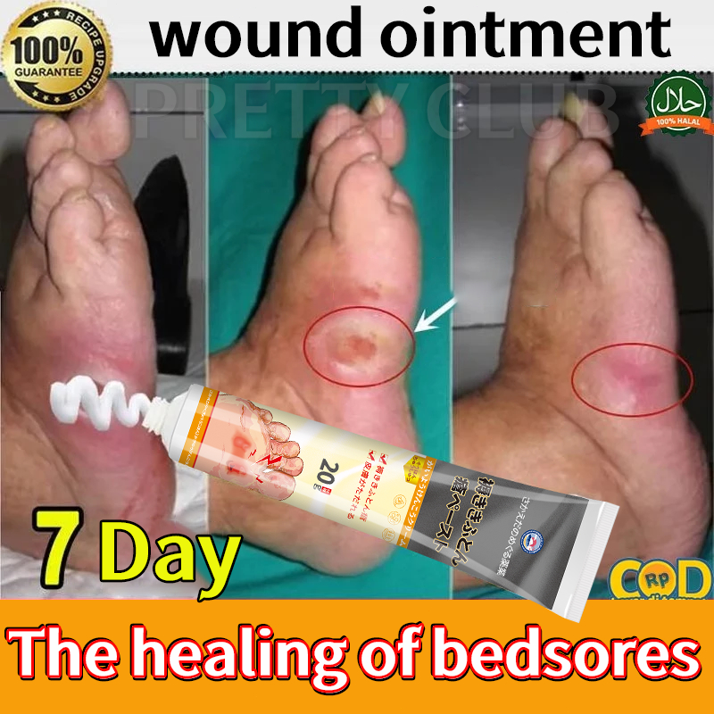 Bedsore Cream 20g Wound Healing Decubitus Feet Care Ointment Pressure ...