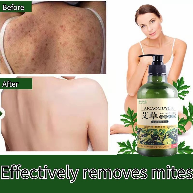 Acne Clear Body Wash 500ml Mugwort Wormwood Anti Bacterial Body Wash Shower Gel Mite Relieve ...