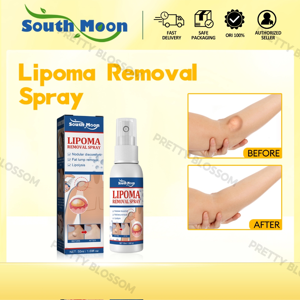 South Moon 50ml Lipoma Removal Spray Lipolysis Fat Lump Relief Plaster ...