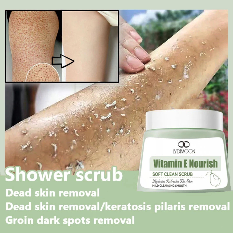 LYDIMOON Body scrub Whitening scrub 250g Remove chicken skin/exfoliate ...
