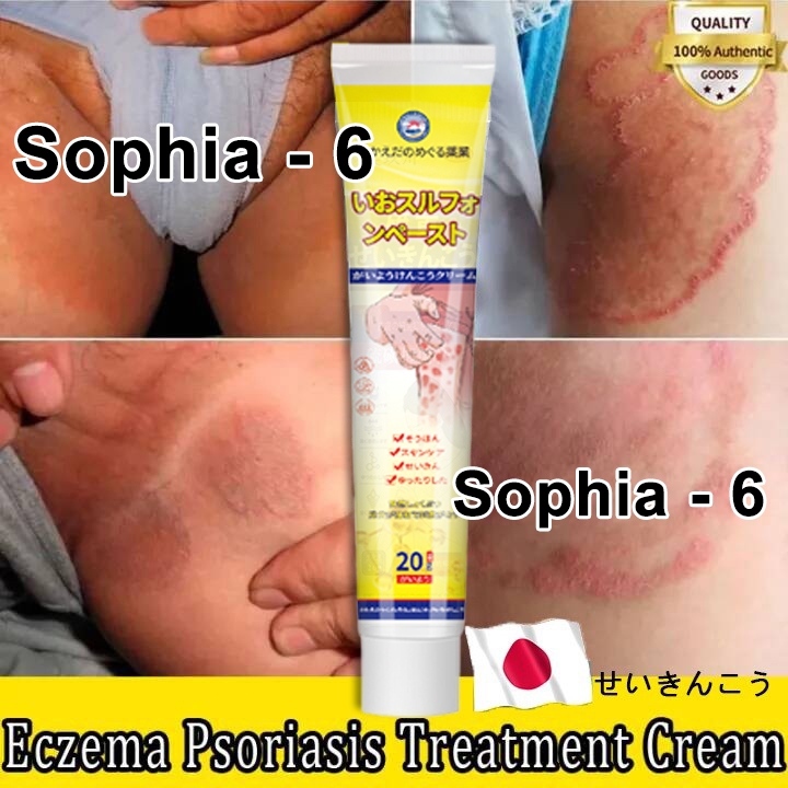 日本止癢膏Japan sulfur antibacterial Cream Treatment of allergic skin, itching, eczema, dermatitis ...