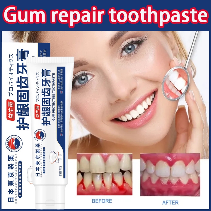 Probiotic Toothpaste 100g Gum atrophy repair regeneration toothpaste ...