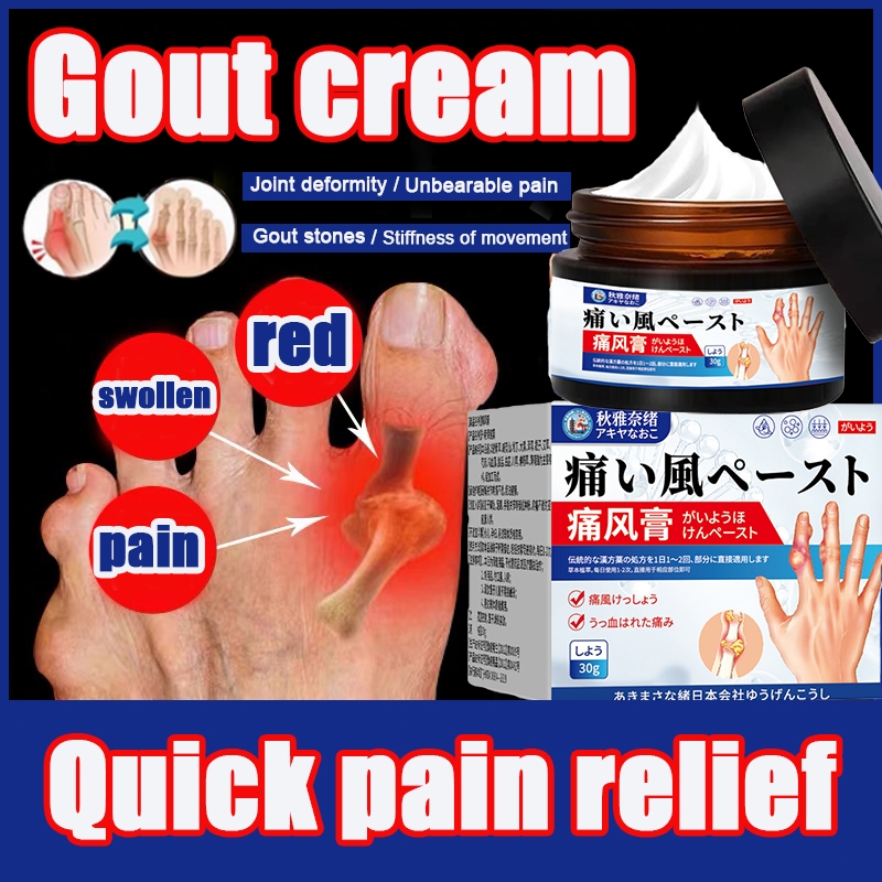 gout medicine 30g gout ointment gout treatment cream eliminate joint ...