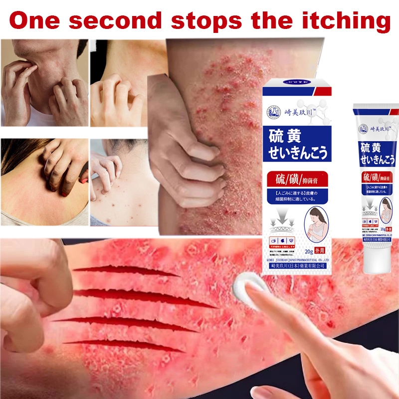 Japan Sulfur Anti itch cream antifungal cream eczema cream inhibits bacteria anti viral relief ...