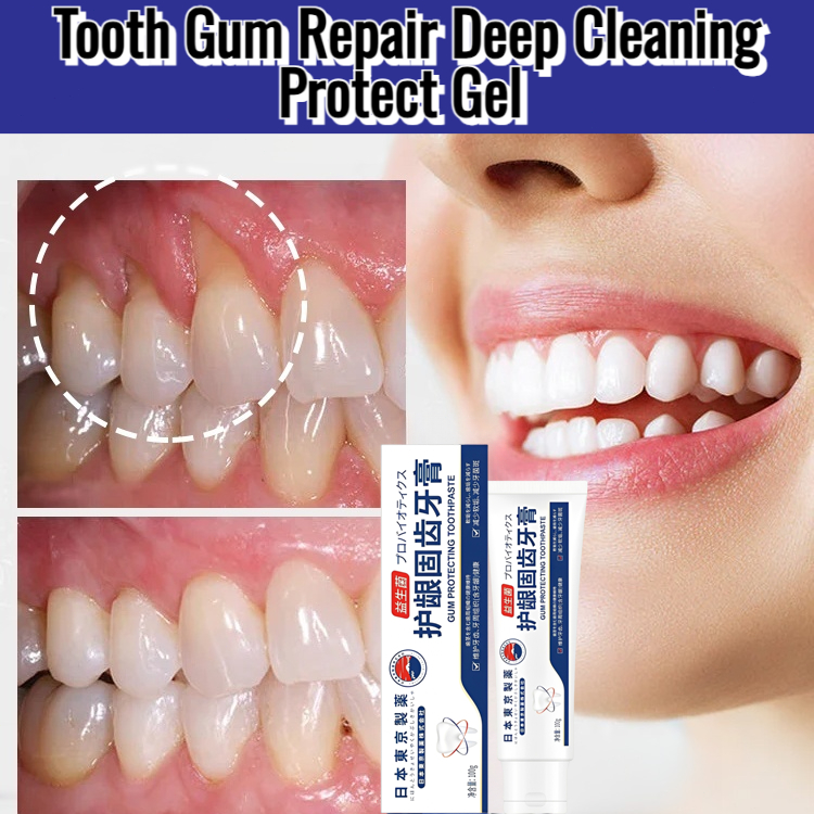 Whitening probiotic toothpaste Gum repair Gum care toothpaste Gum ...