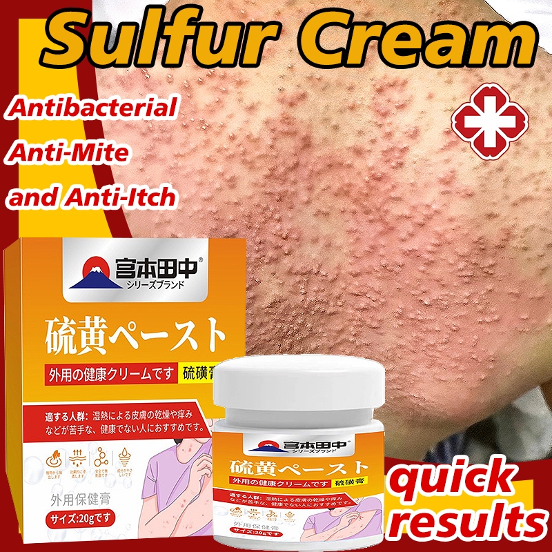Sulfur Anti Itch Cream 20g Eczema itchy skin cream Psoriasis Ointment antibacterial anti-itch ...