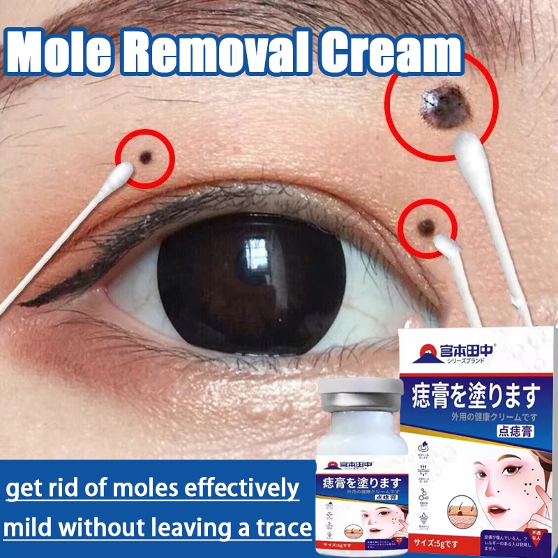 mole removal/wart remover/skin tag remover cream/concentrated potent ...