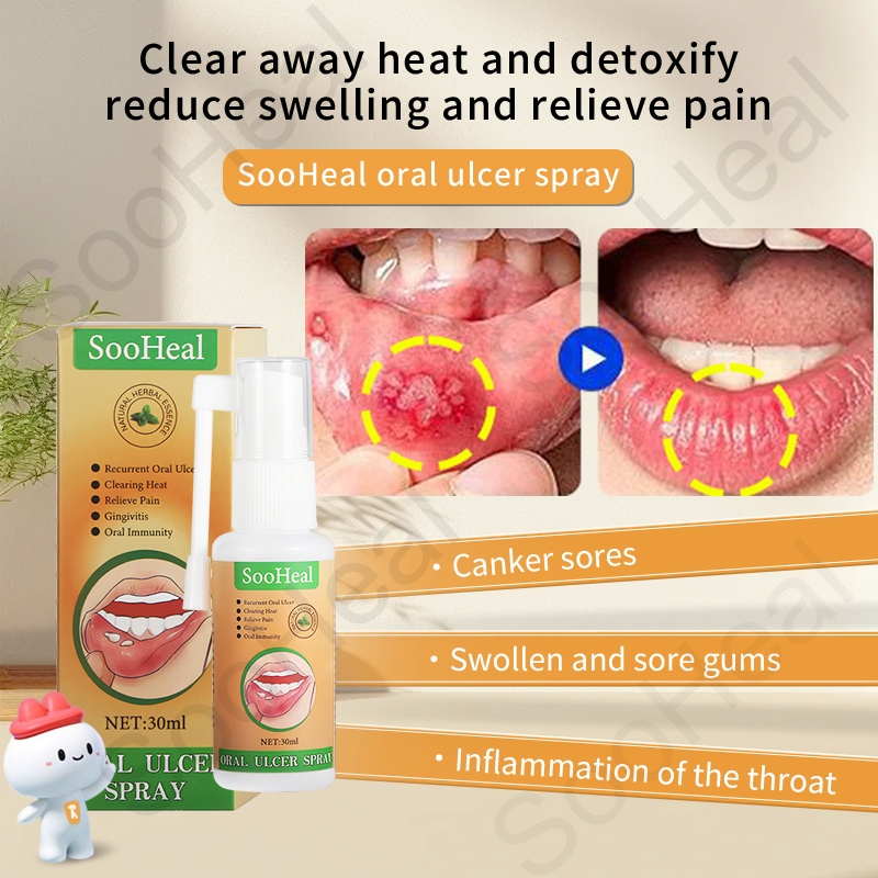 mouth ulcer ulcer spray 30ml Bleeding gums bubbles at the corners of ...