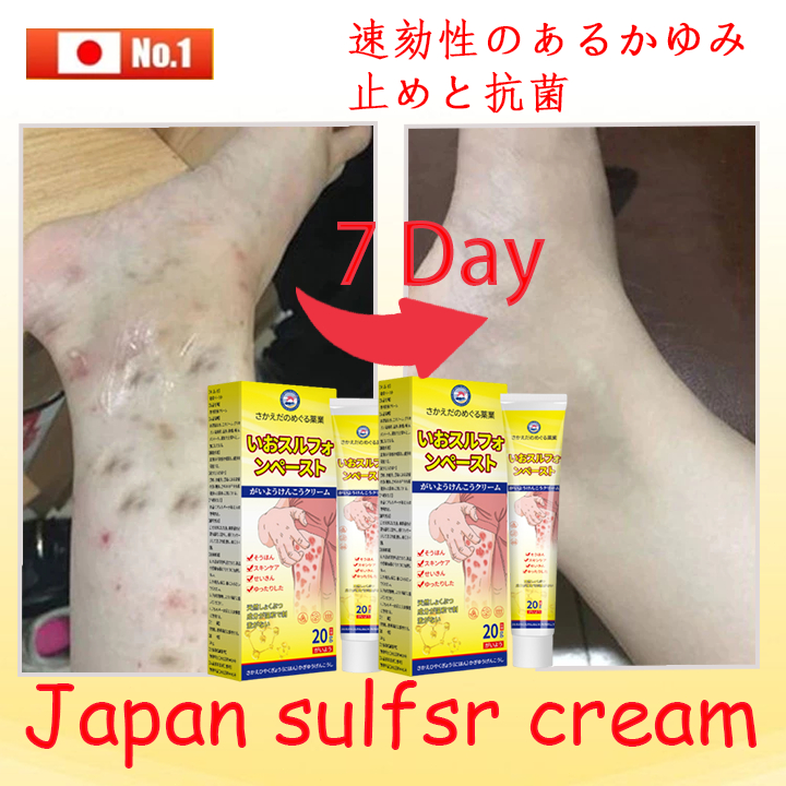 Japan Sulfur Eczema Antifungal Cream for Itchy Skin Anti Itch Cream Treats Psoriasis Private ...