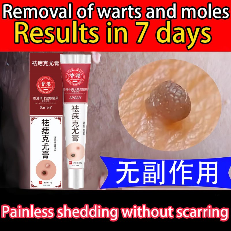 Wart Removal Cream Warts Removal Skin Tag Remover 20g 7Days Effective ...