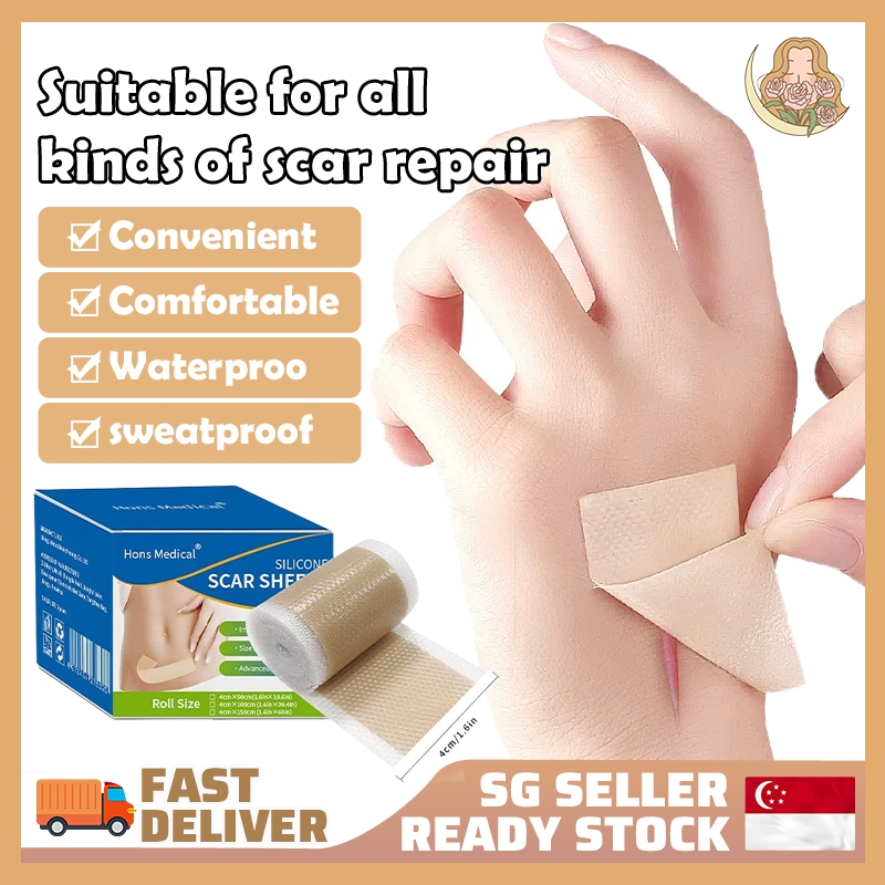 Scar Removal Medical Silicone Scar Sheet 4cmx50cm Treatment Scar ...