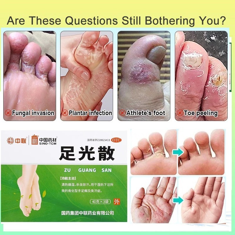[ Ready Stock- E:2026/27]Rotten Foot Powder/ Stinky Foot Powder ...