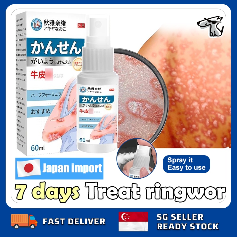 [SG Stock] Japan eczema special potion 60ml Antibacterial Anti-Itch ...