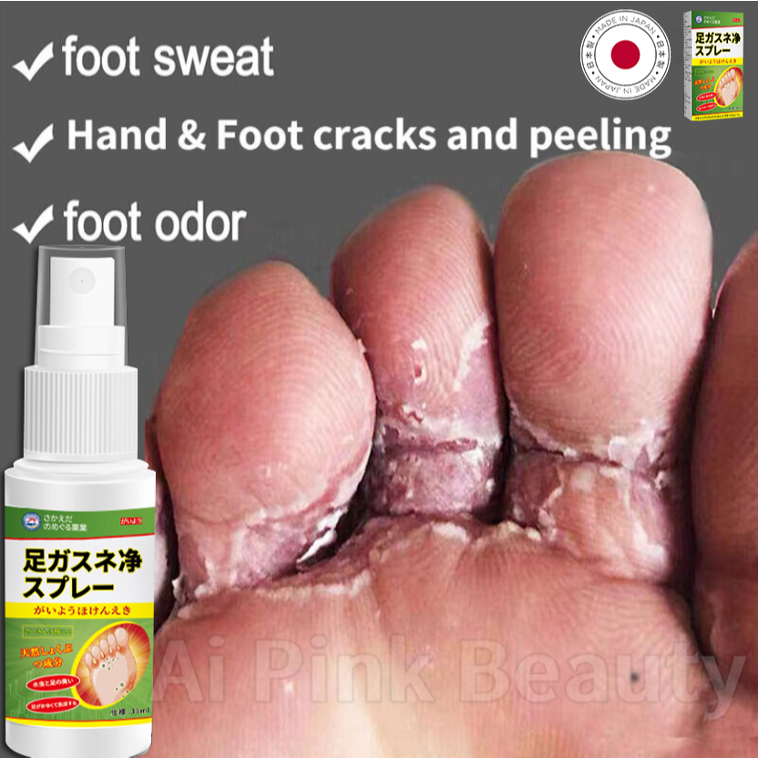 Anti-fungal Foot Spray 35ml feet deodorant spray Say Bye to Fungus and ...