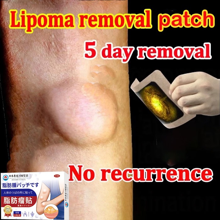 Lipoma Removal Patches 12pcs/box Lipoma Patch Treat Tumor Skin Swelling ...