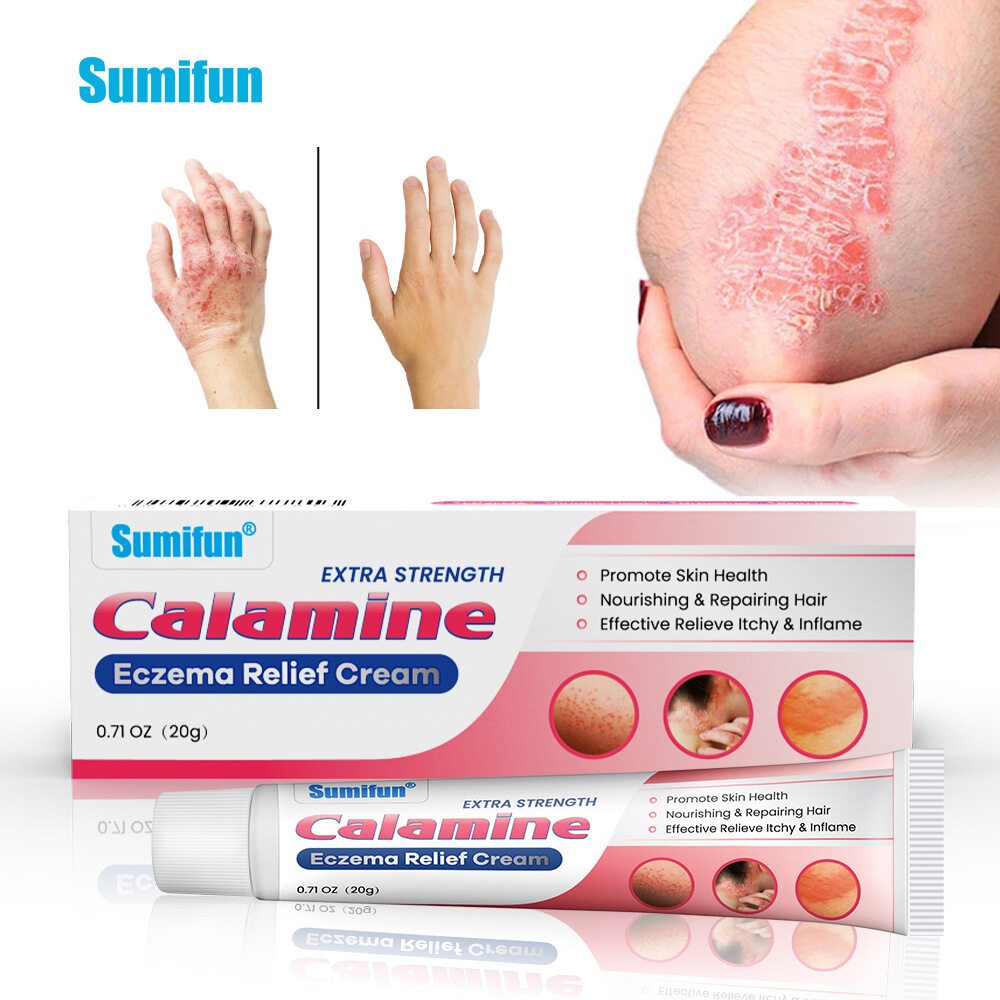 Sumifun Itchy Skin Cream Calamine Eczema Relief Cream 20g | Shopee ...