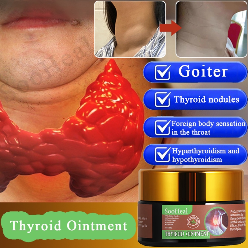 thyroid cream 20g Eliminate goiter thyroiditis thyroid nodules ...