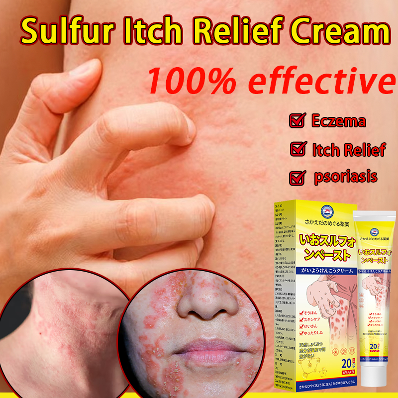 antiacterial anti itch eczema cream sulfur cream 20g anti-inflammatory ...