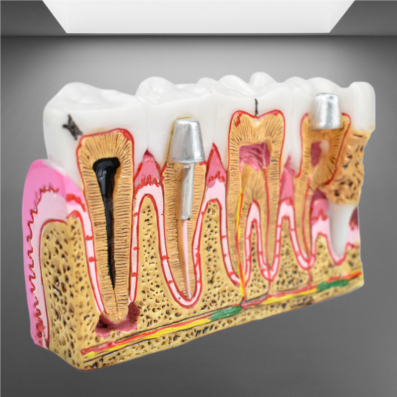 Dental Pathologies Model Comprehensive Pathology Teeth Models Dental ...