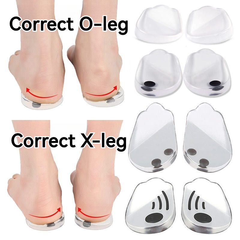 Ready Stock 5-day delivery Correct Leg Shape Insole o-Shaped Leg ...