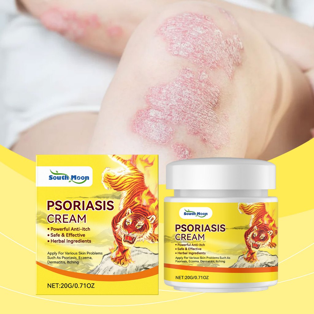 South Moon Tiger Anti Psoriasis Ointment Psoriasis cream Eczema ...