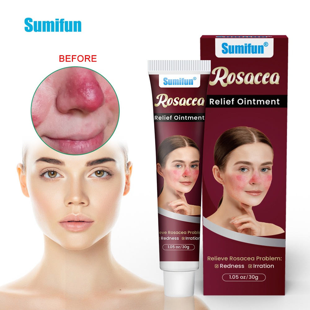 rosacea relief ointment Extra Strength Rosacea Ointment Acne Repair ...