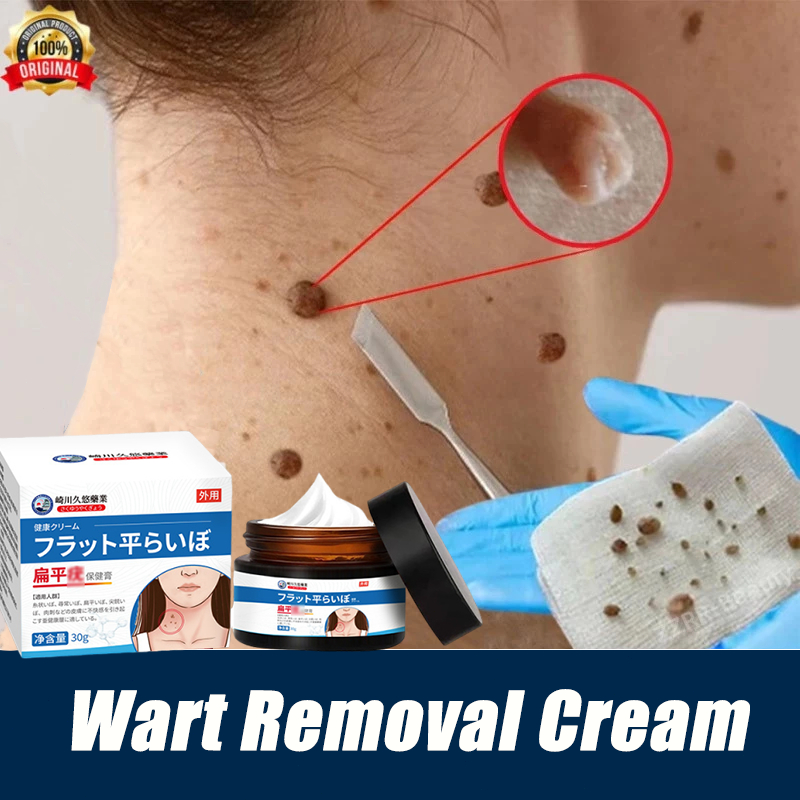 Wart removal cream 30g Mole Skin Tag Remover painless wart removal ...