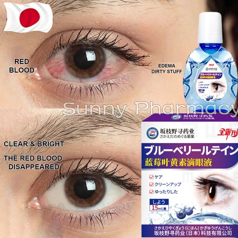 Eye care solution 15ML relieves cataracts, dry eyes, sore eyes, red ...