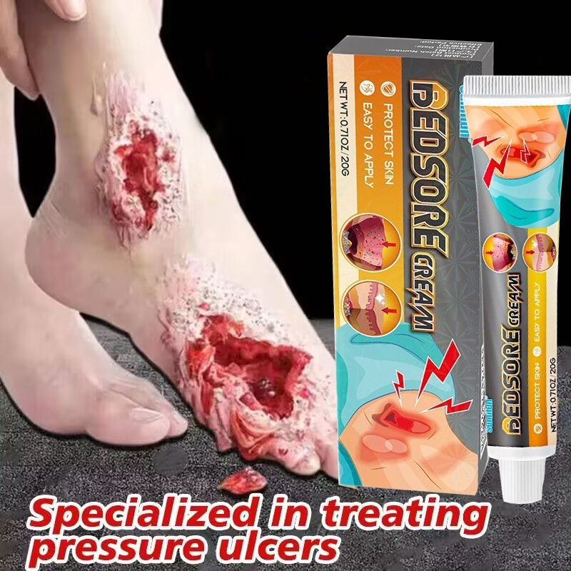 Bedsore Cream 20g antiseptic pressure sore cream decubitus ulcer ...