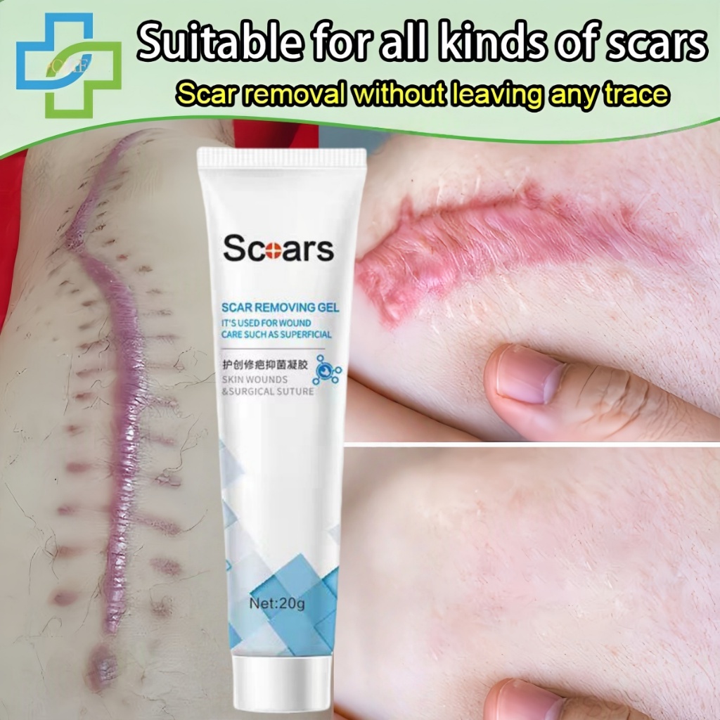 Scar Removal Cream Repair Hyperplastic Scars Surgical Scars Burn Scars ...