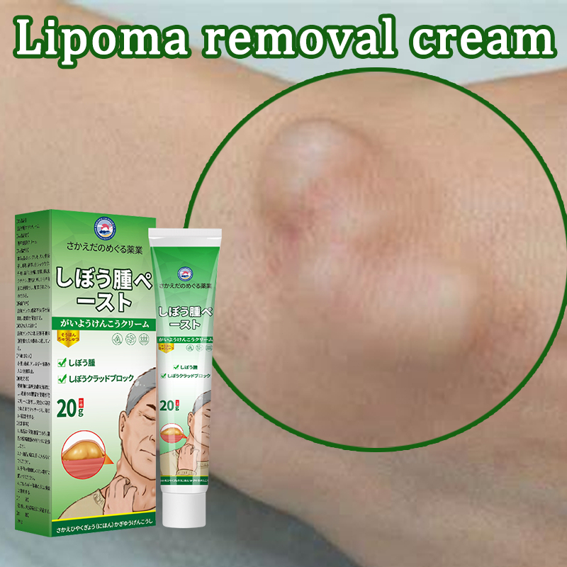 Lipoma removal cream 20g Lipoma Removal Cream Lipolysis Fat Lump Relief ...