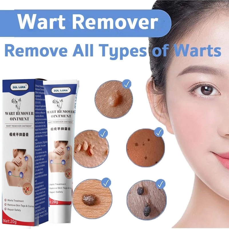 Fast wart removal cream with no scars, quick removal of moles and warts ...