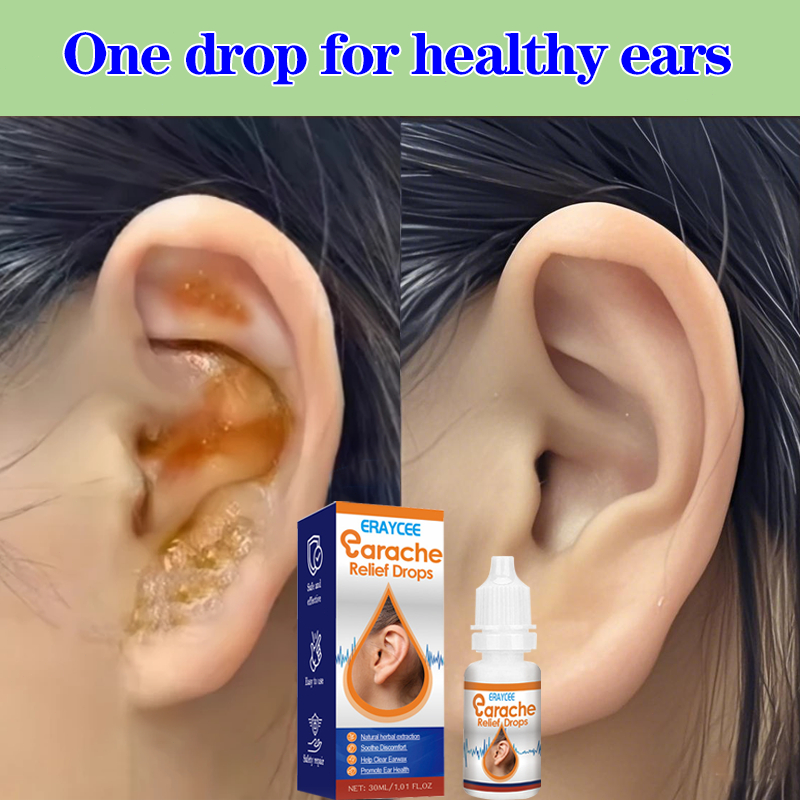 Medical ear drops Ear drops for itchy and tinnitus 30ml remove ear wax ...
