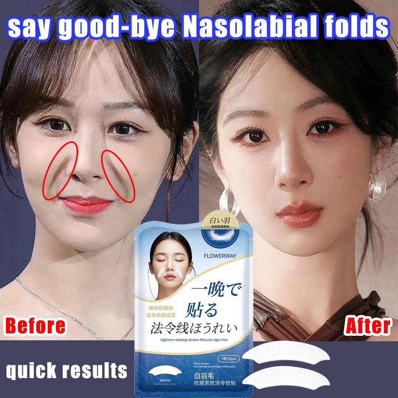 Nasolabial Fold Patch 18PCS Face Wrinkle Patch Anti Wrinkle Patch 法令纹贴 ...