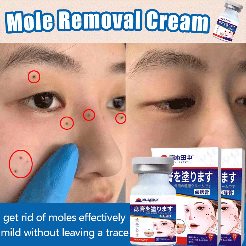 Japan Mole Remover Cream wart removal Skin Tag Remover Cream 100% ...