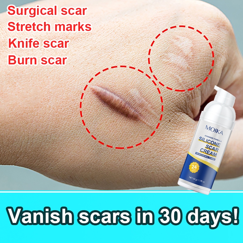 Scar Gel Scar Remover Cream Scar Reduction Cream Surgical Burning Scars ...