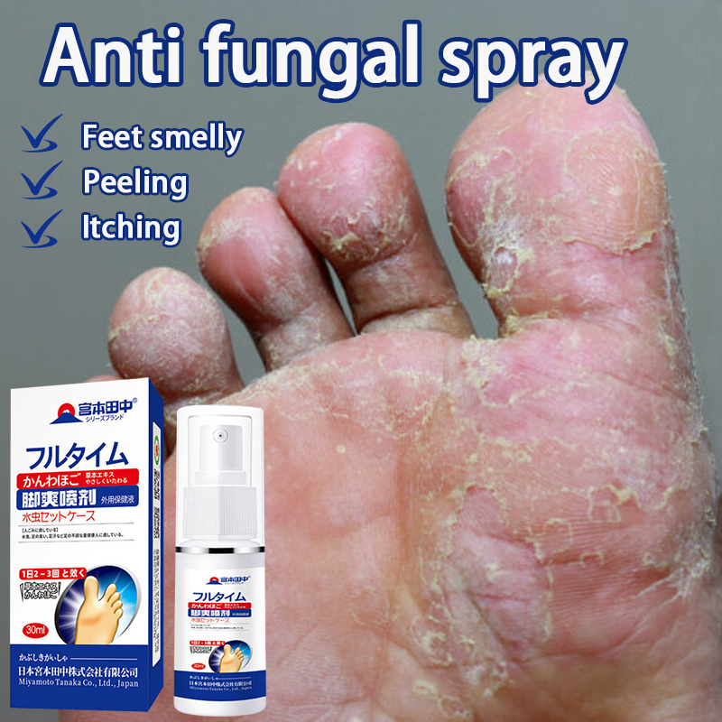 Anti fungal spray foot deodorant spray 30ml athlete foot treatment ...