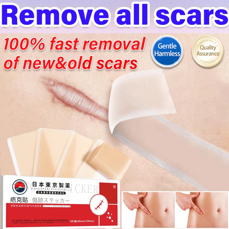 [Japan] Scar Removal Patches Scar Care Cream for Removing Acne Scars ...