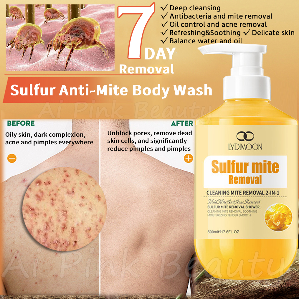 Acne Body Wash 500ml sulfur Mite Removal Whitening Body Wash Anti Itch ...
