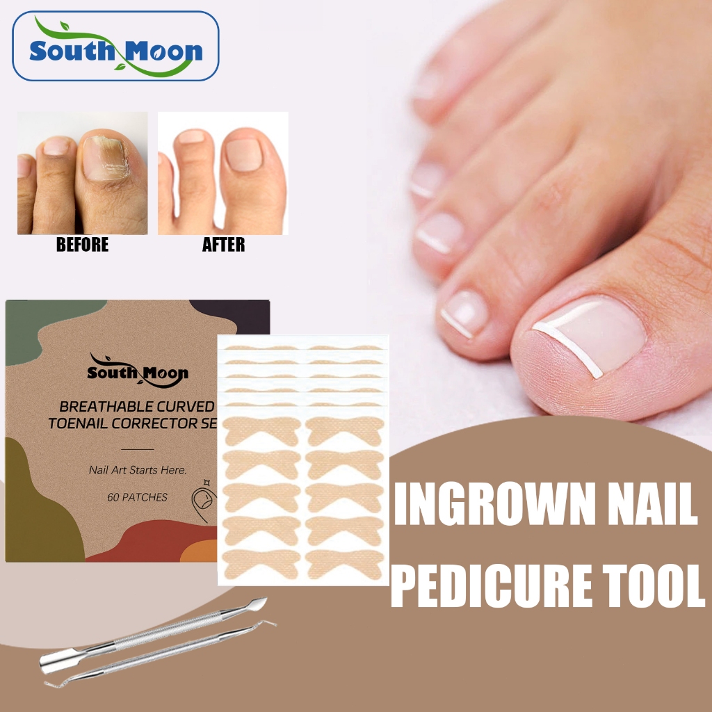 South Moon Nail Groove Pull Patch Ingrown Nail Pedicure Tool Nail ...