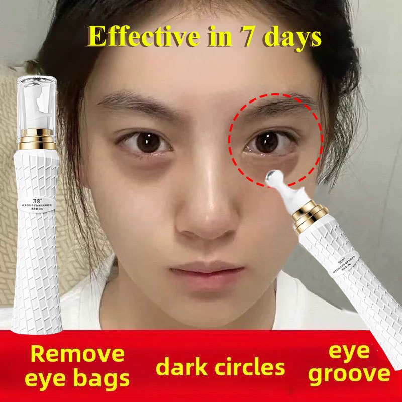 Eye Cream eye bag removal Eye Serum 20g Dark circles removal Fat ...