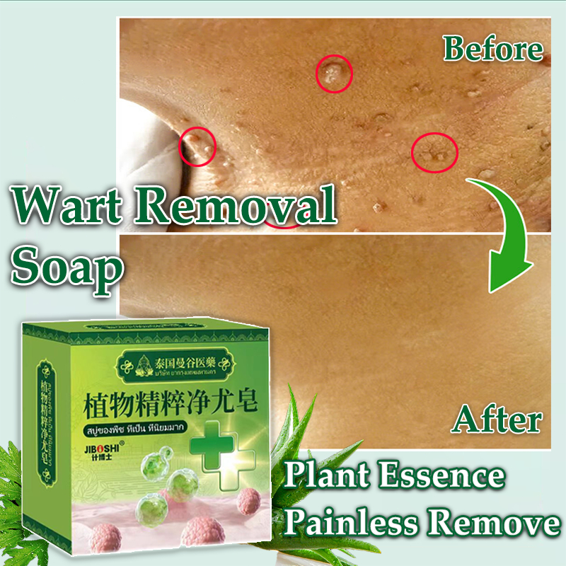 [Fast Shipping] Thailand Wart Removal Soap Skin Tag Remover Soap 80g ...