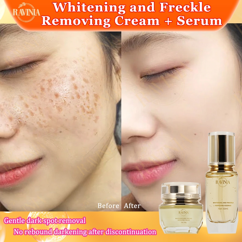 RAVINIA Dark spot remover serum 50ml Whitening&Freckle removing essence ...